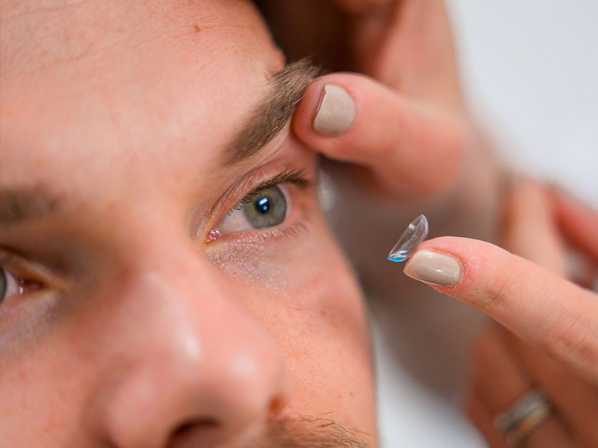 5 Types of Contact Lenses for "Hard-to-Fit" Patients