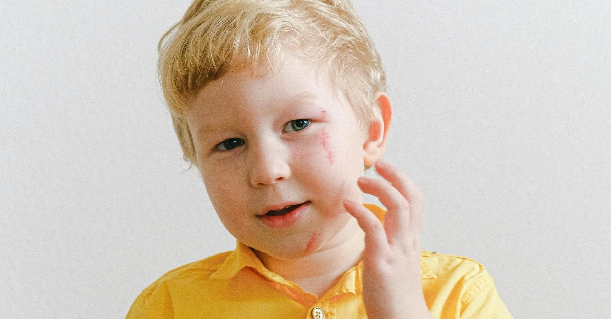 Understanding Eye Injuries at Home - Insight Vision Center Optometry